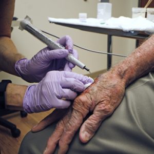 Surgical Dermatology - Dermatology Associates of Virginia, P.C.